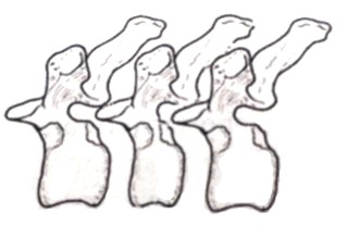 Hemivertebrae & Vertebral Malformation - Melbourne Bulldog Clinic